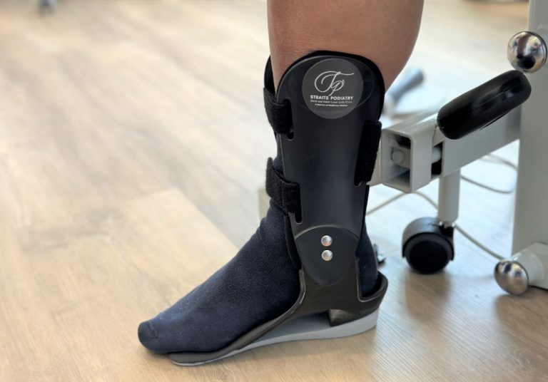 Foot Drop | Signs, Symptoms, Management | Straits Podiatry