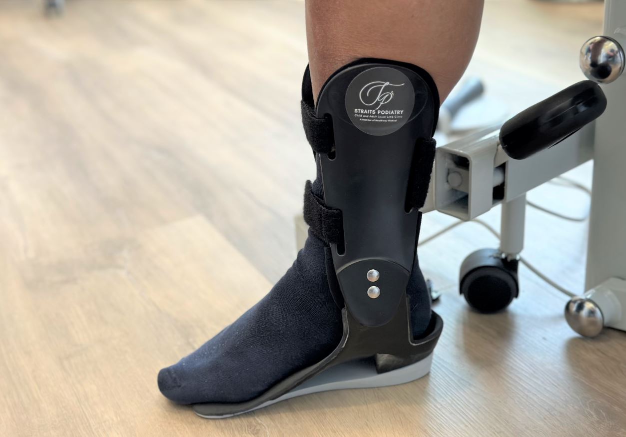 Foot Drop | Signs, Symptoms, Management | Straits Podiatry