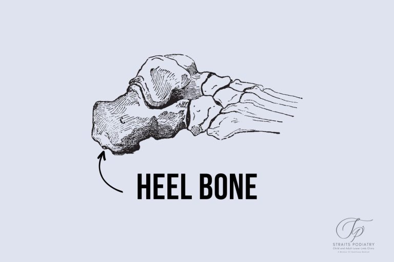 Anatomy of the Heel: Understanding the Complex Structure - Straits Podiatry